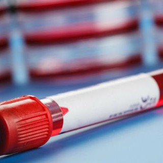 Şizofreni kan testi ile teşhis edilecek | Farmaskop